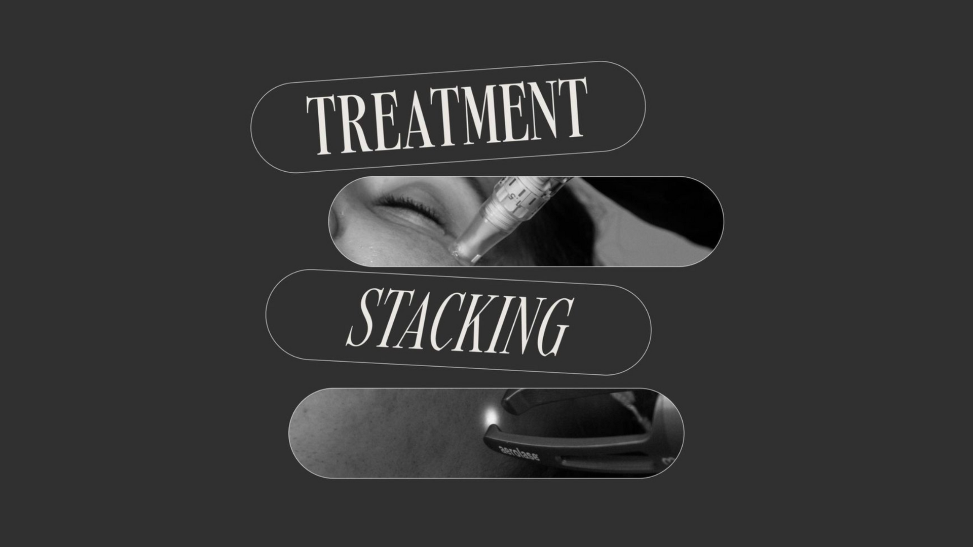 Treatment Stacking 101 - KOZA